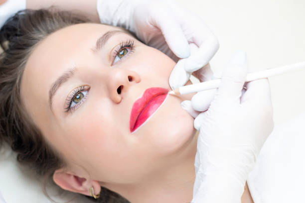 Lip Filler Bruising: A Comprehensive Guide on Healing & Recovery